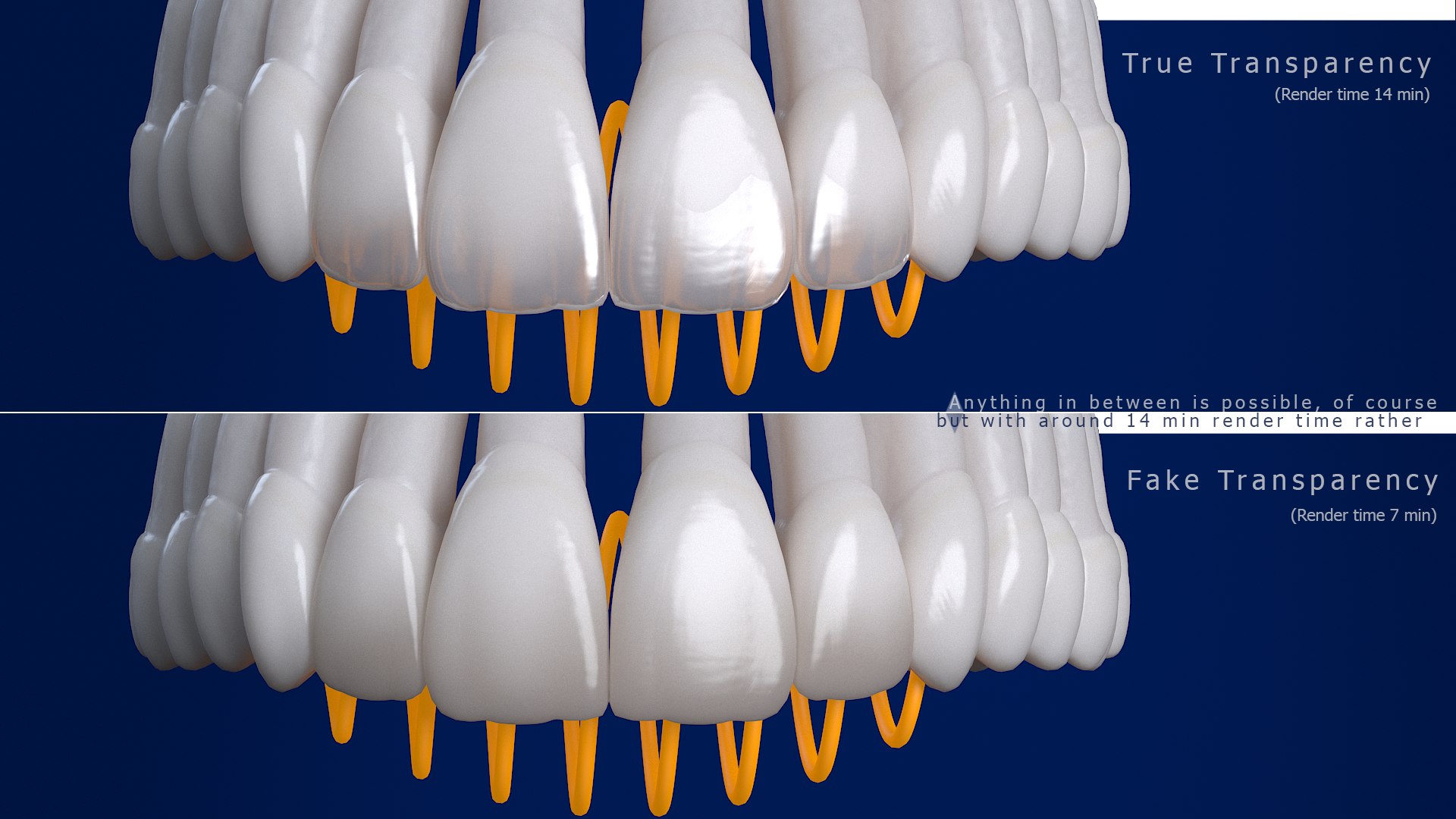 Teeth With Head 3D Model - TurboSquid 2345191