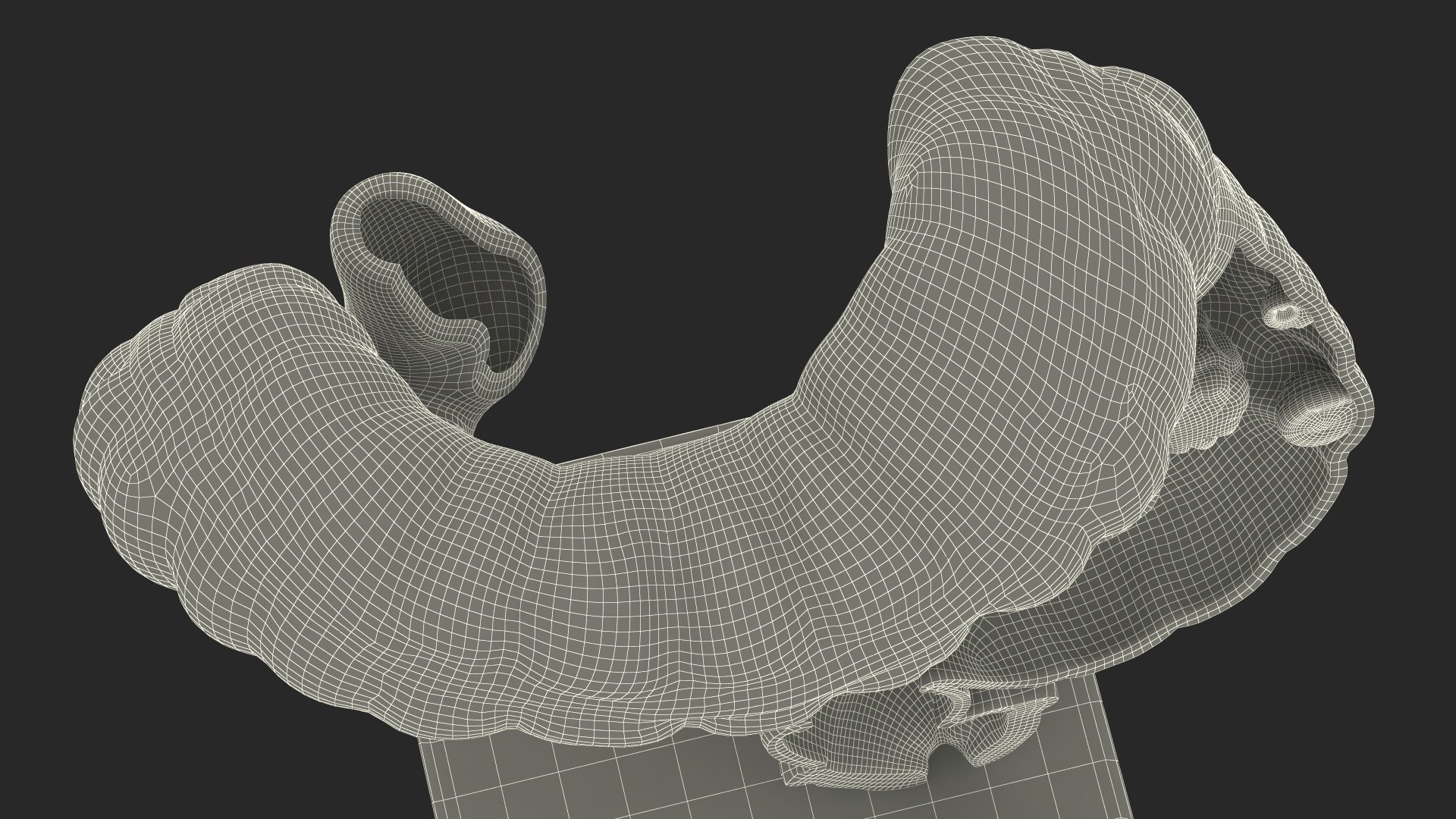 Medical Model Diseased Intestine Model - TurboSquid 2068464