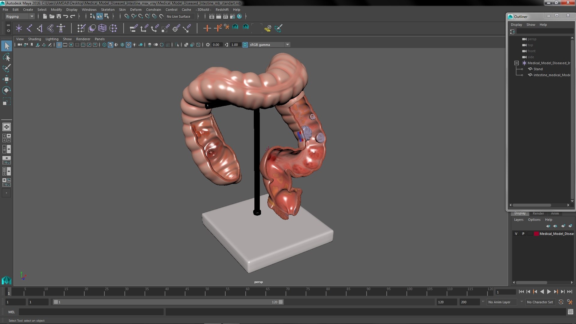 Medical Model Diseased Intestine Model - TurboSquid 2068464