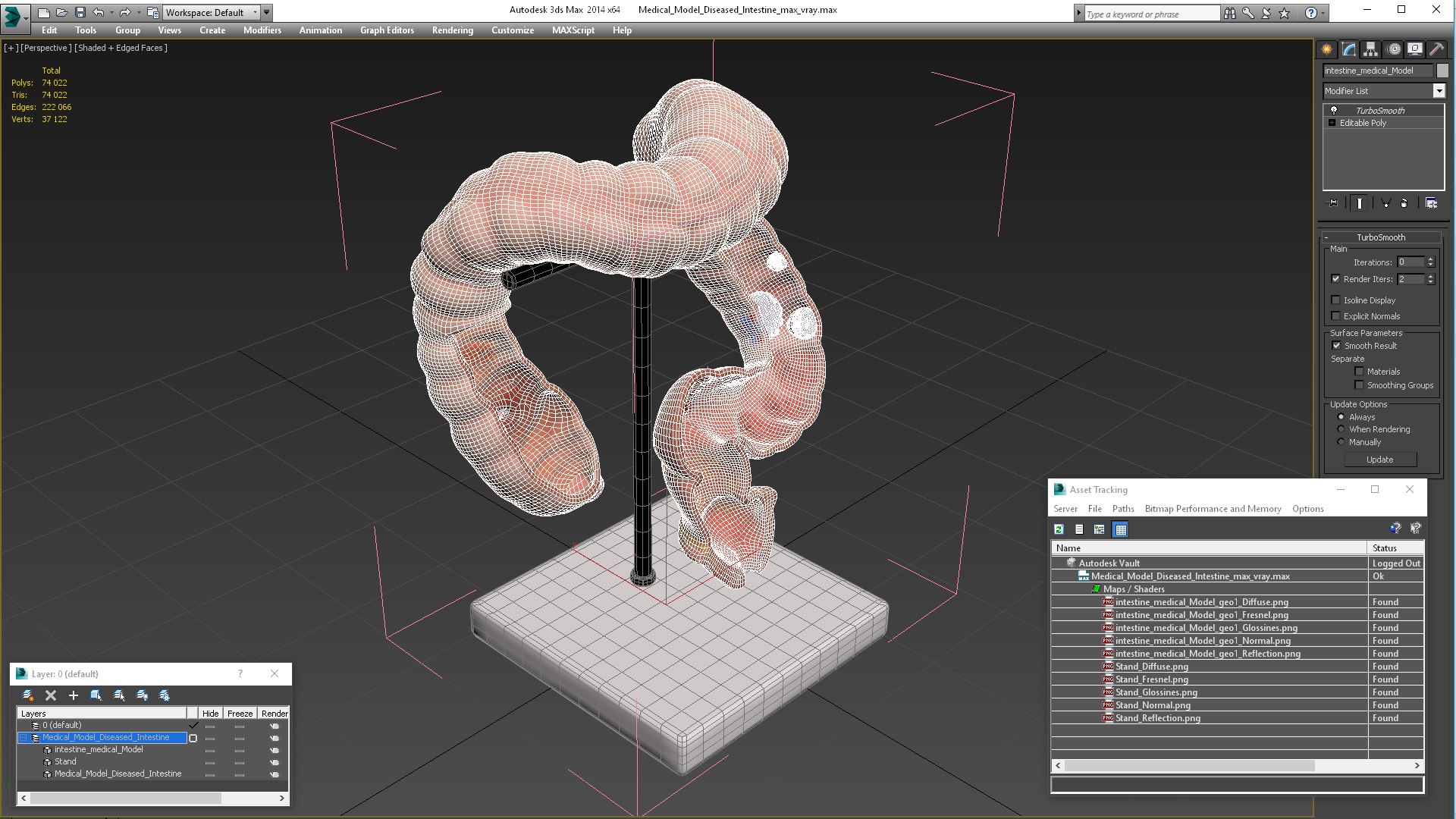 Medical Model Diseased Intestine Model - TurboSquid 2068464