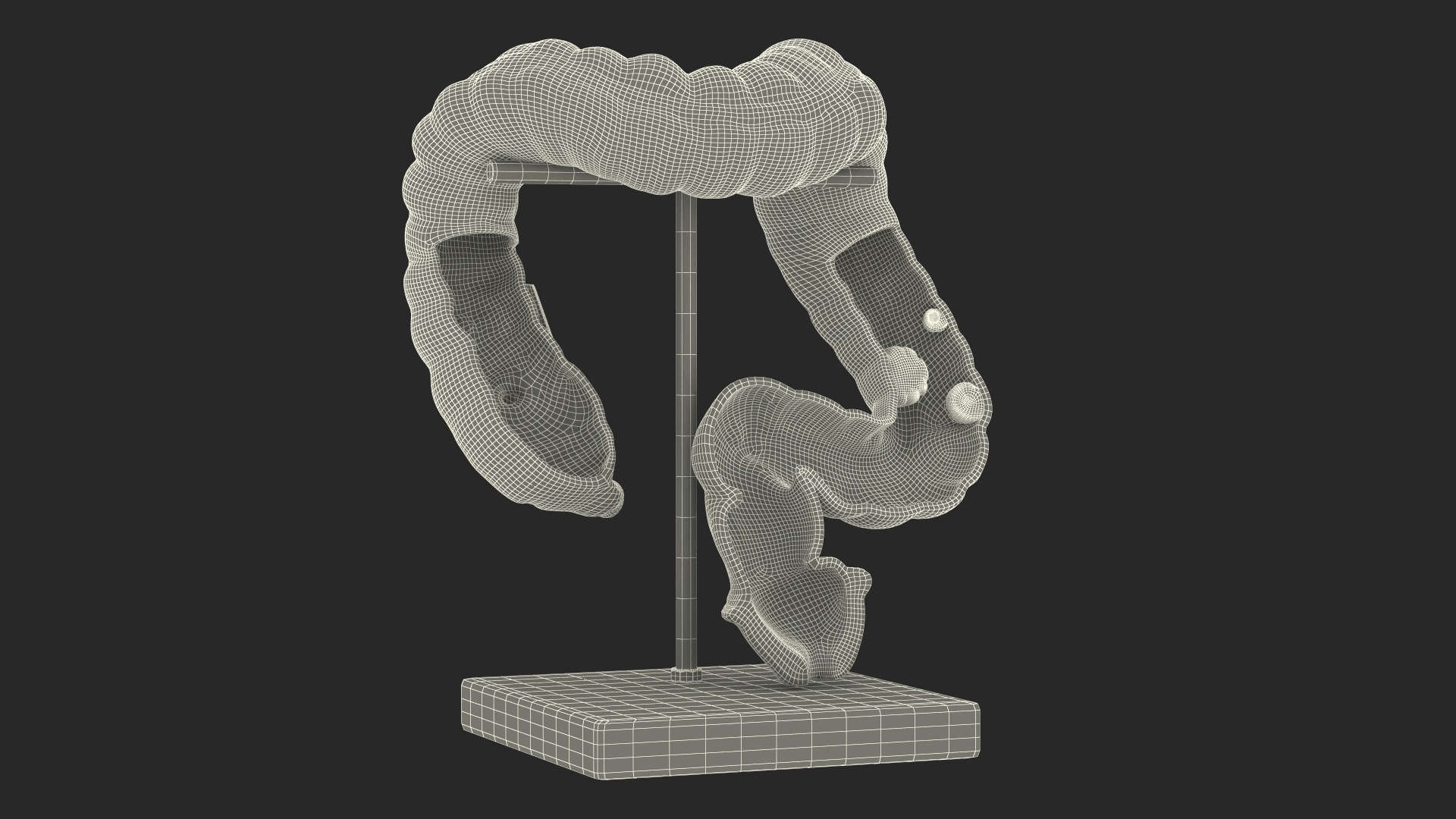 Medical Model Diseased Intestine Model - TurboSquid 2068464