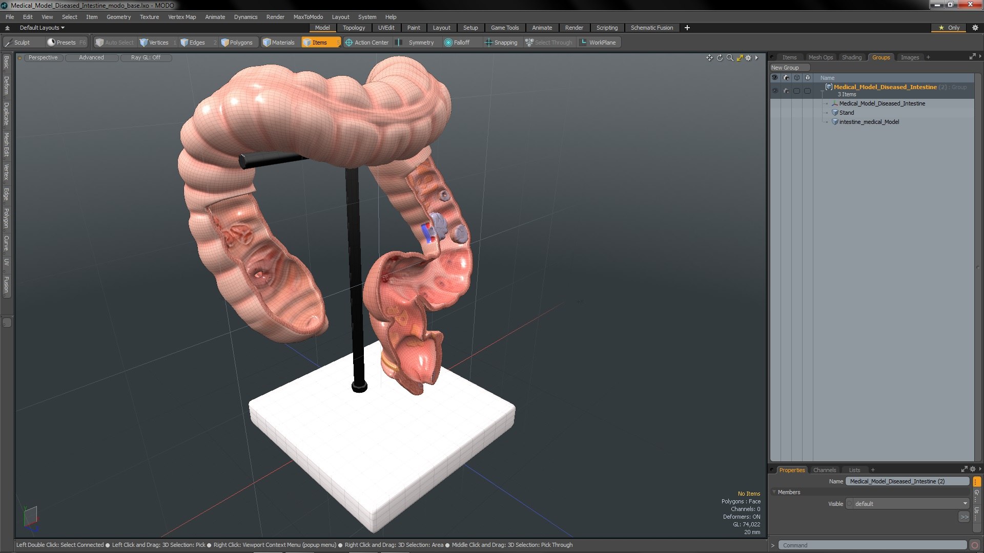 Medical Model Diseased Intestine Model - TurboSquid 2068464
