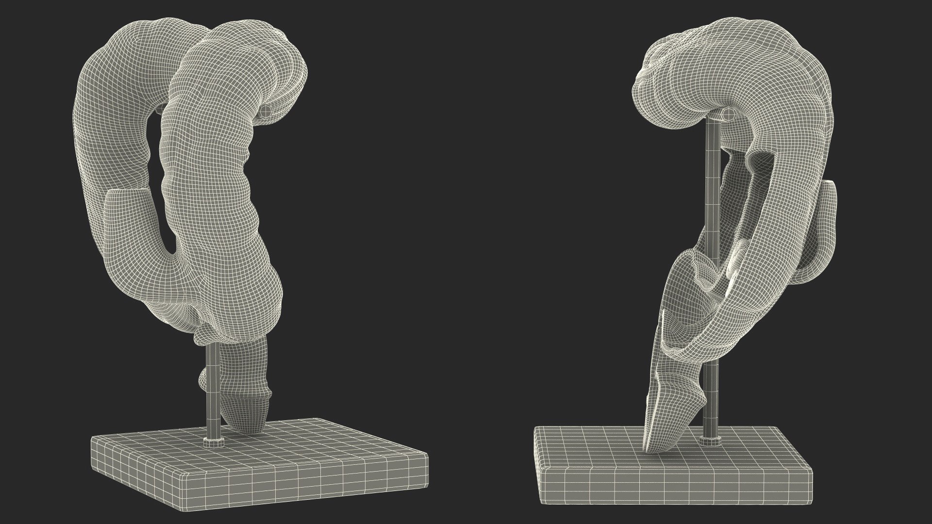 Medical Model Diseased Intestine Model - TurboSquid 2068464
