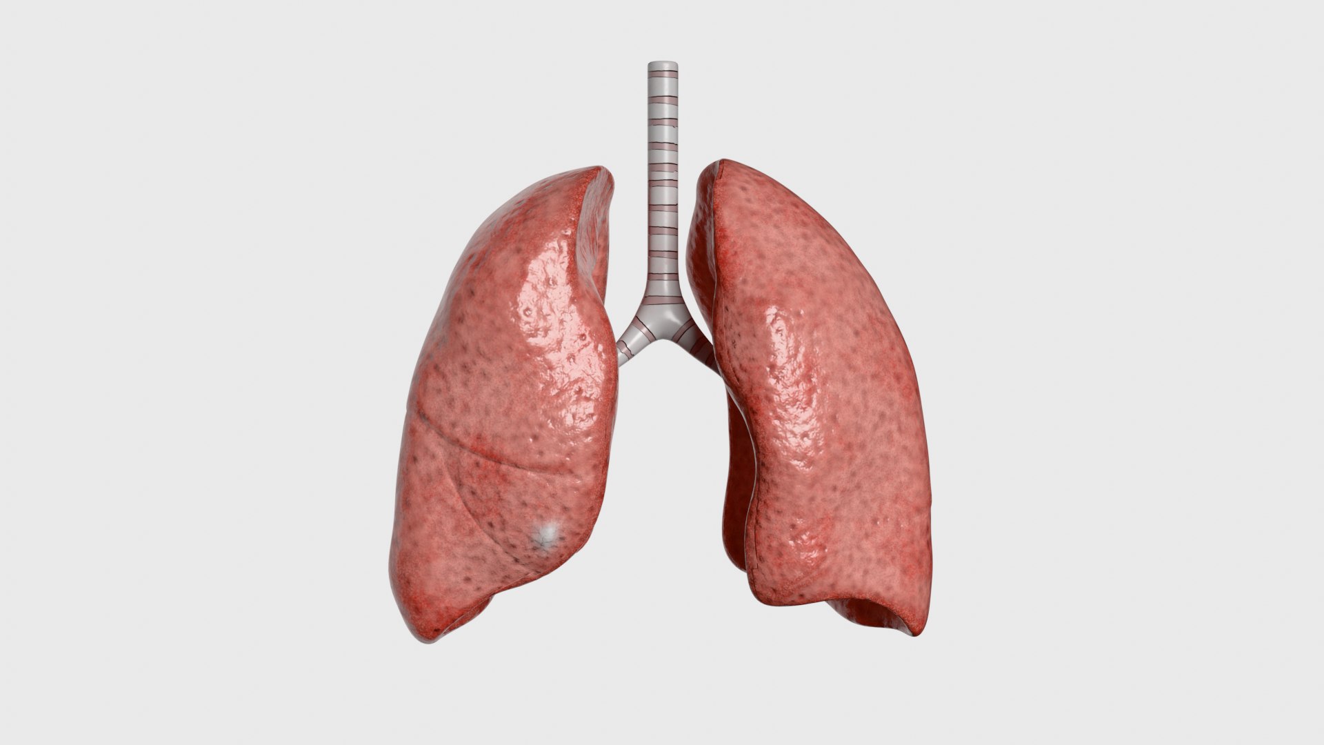 3D Model Lung Cancer Stage Anatomy - TurboSquid 2454899