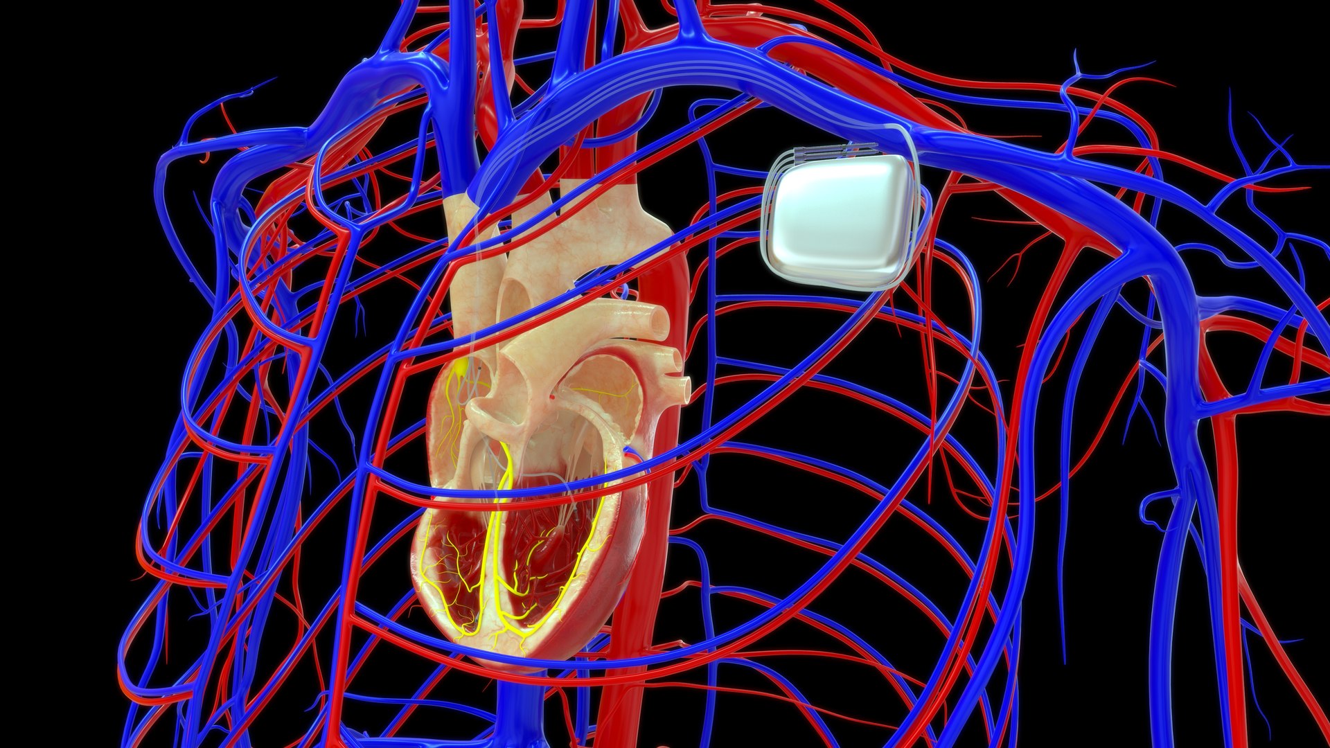 3D Heart Artificial Pacemaker With Circulatory System Model ...