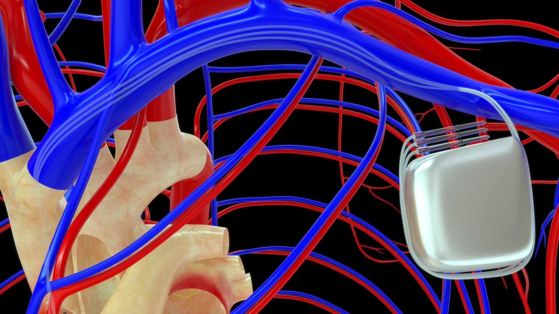 3D Heart Artificial Pacemaker With Circulatory System Model ...