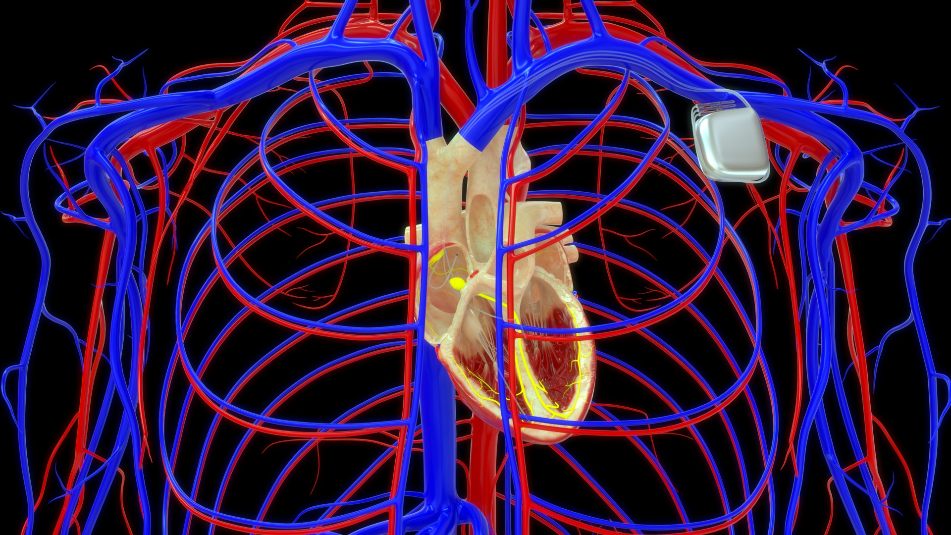 3D Heart Artificial Pacemaker With Circulatory System Model ...