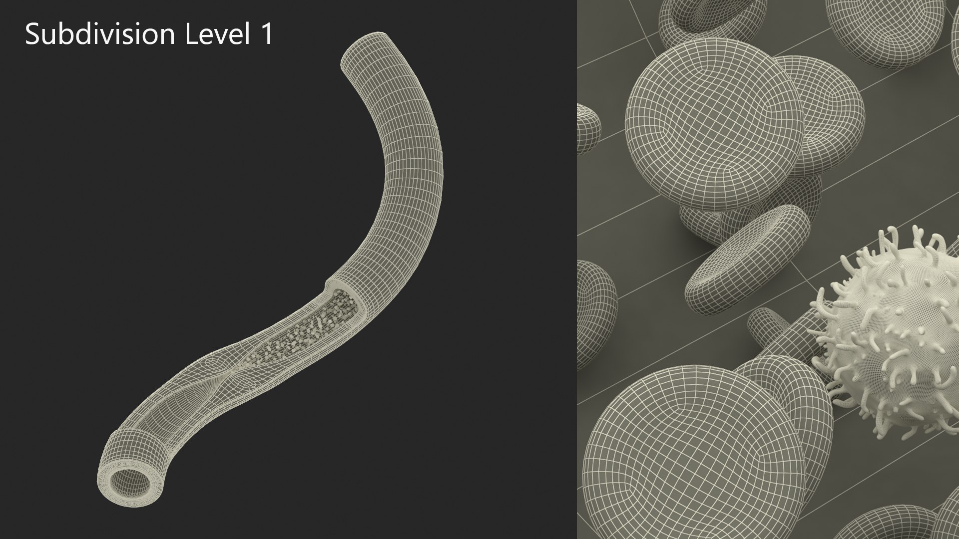3D Cholesterol Blocked Artery In Cross Section Model - TurboSquid 2330141