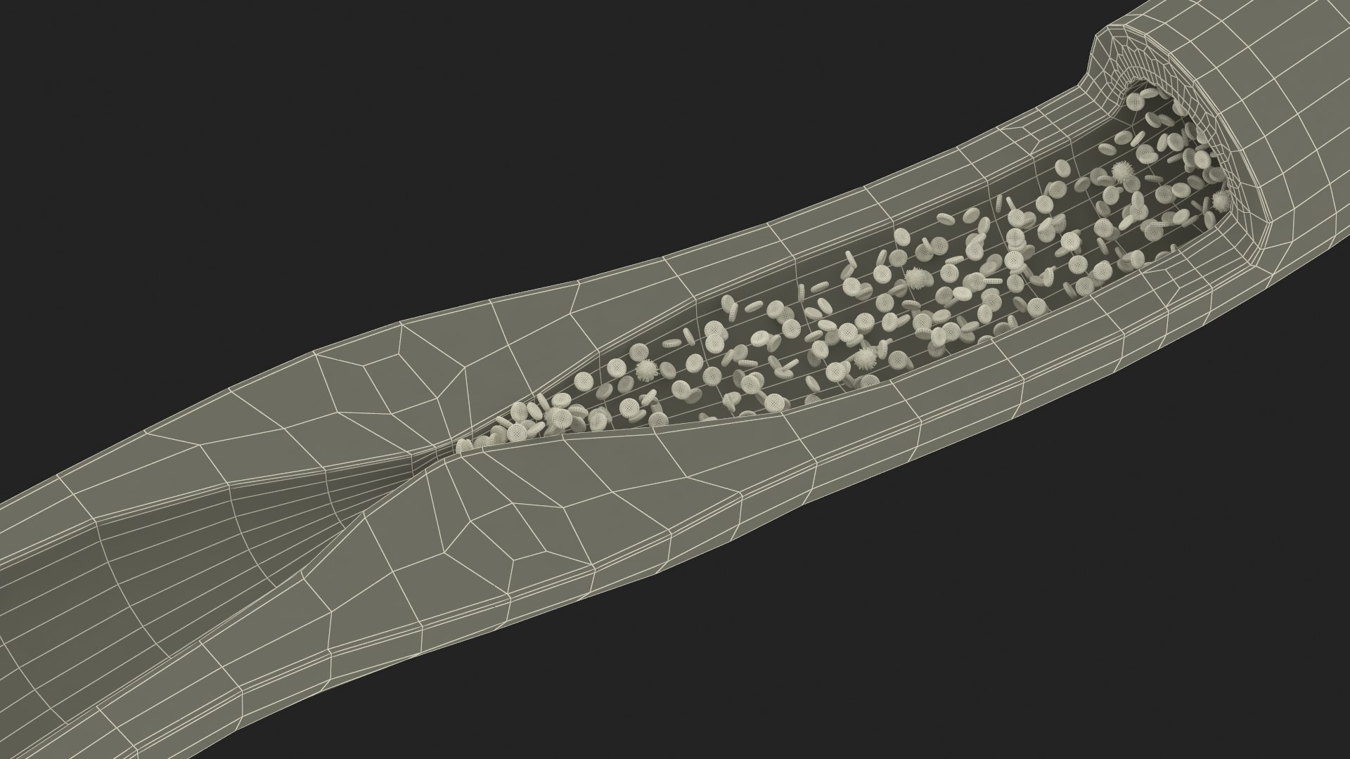 3D Cholesterol Blocked Artery In Cross Section Model - TurboSquid 2330141
