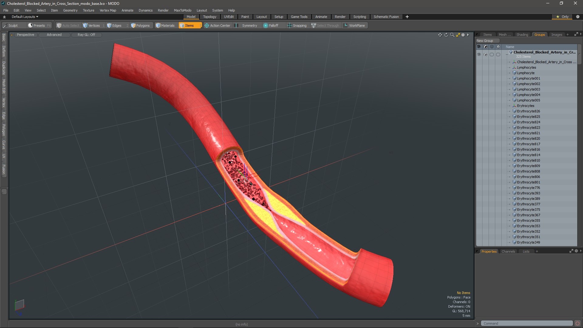 3D Cholesterol Blocked Artery In Cross Section Model - TurboSquid 2330141