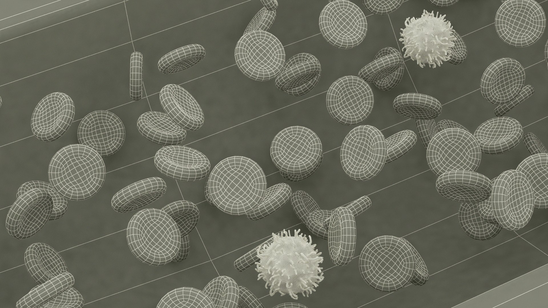 3D Cholesterol Blocked Artery In Cross Section Model - TurboSquid 2330141
