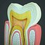 Tooth Section Obj
