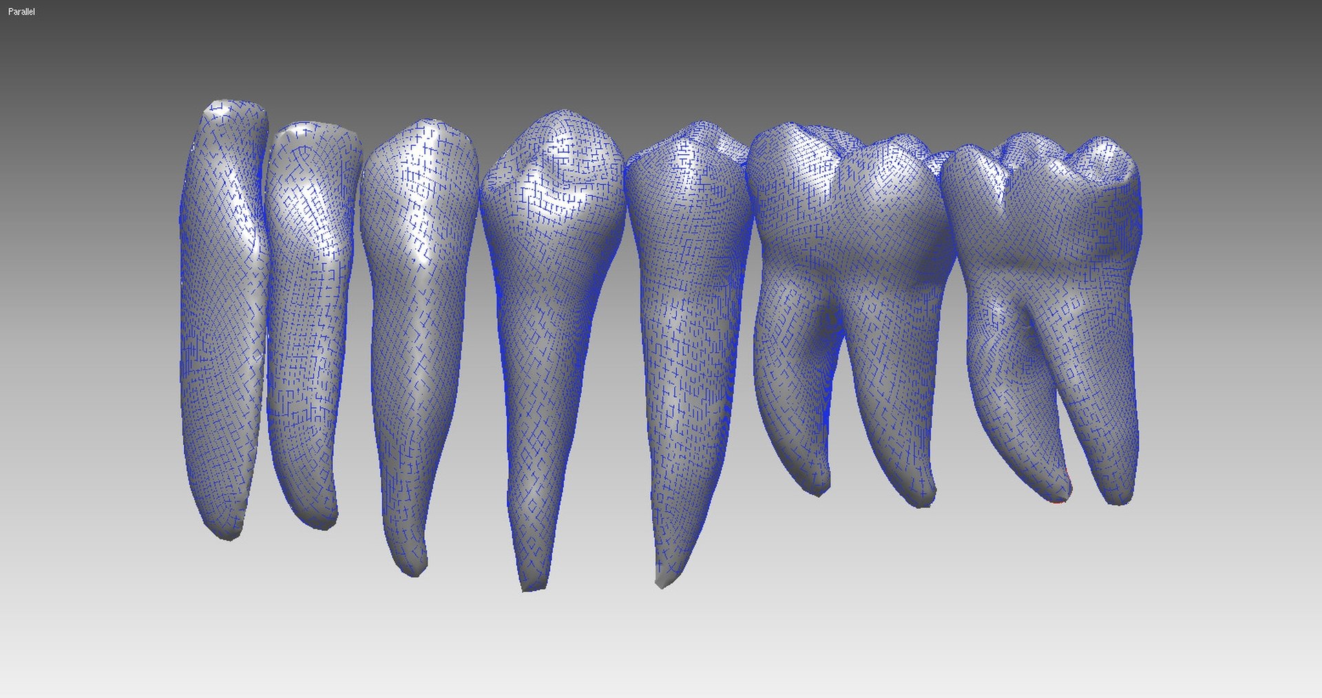 3D Mandible Teeth Surface Model - TurboSquid 1816091