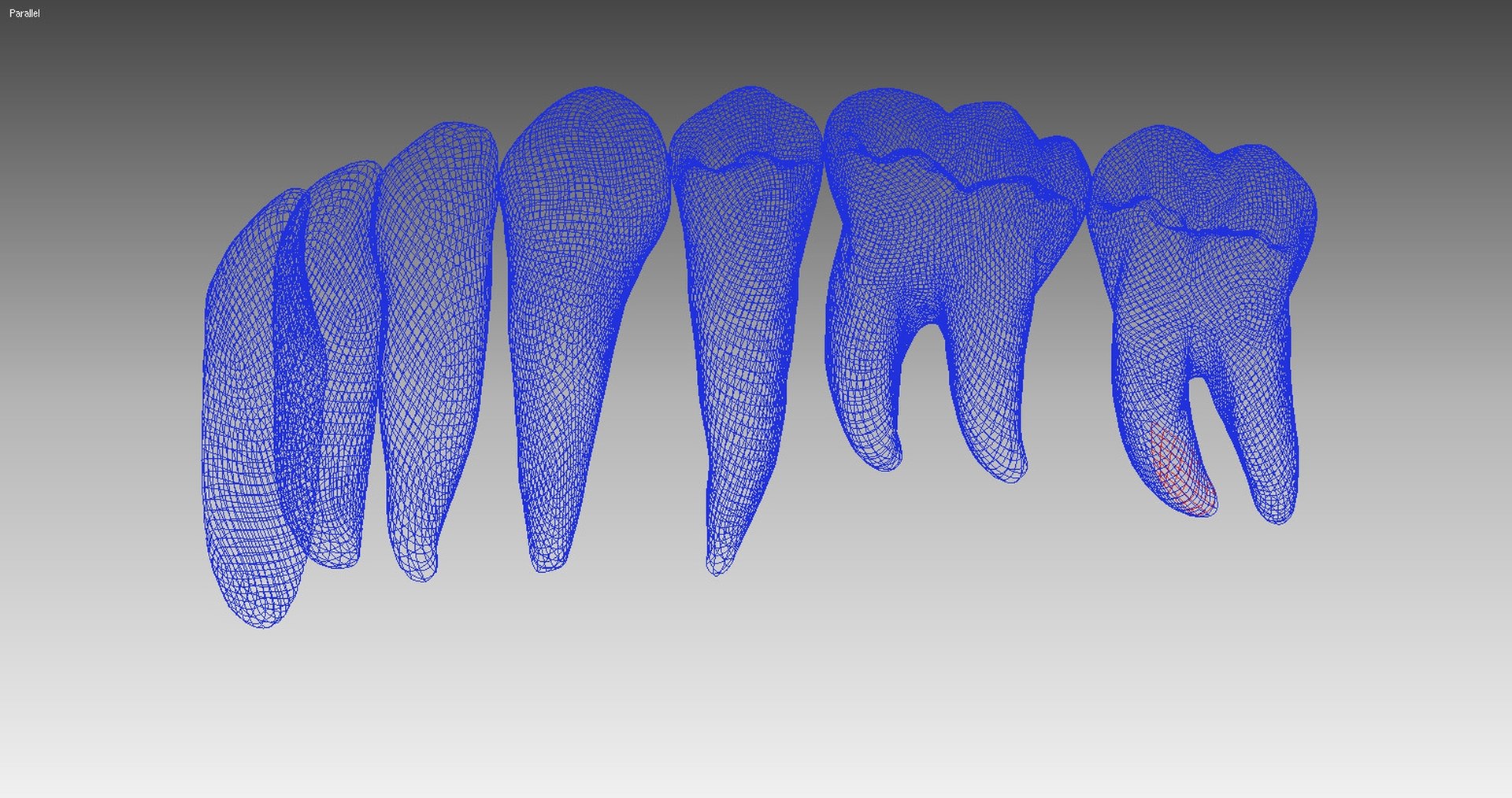 3D Mandible Teeth Surface Model - TurboSquid 1816091