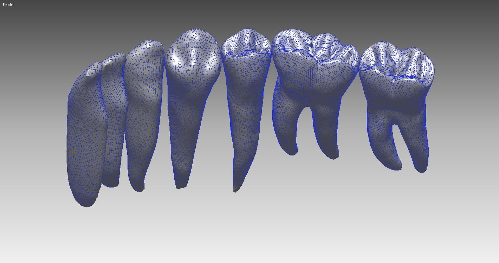 3D Mandible Teeth Surface Model - TurboSquid 1816091