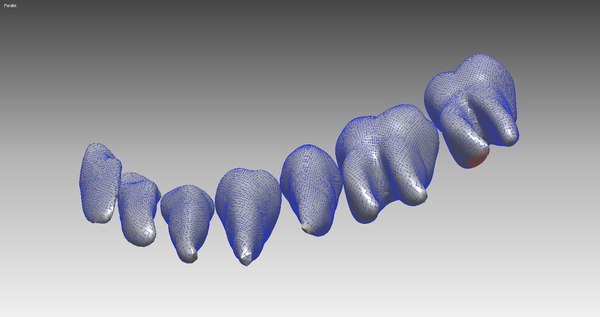 3D Mandible Teeth Surface model - TurboSquid 1816091