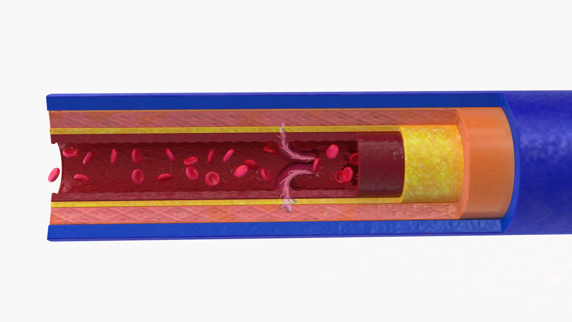 3D Human Blood Vessels Capillary Model - TurboSquid 1652764