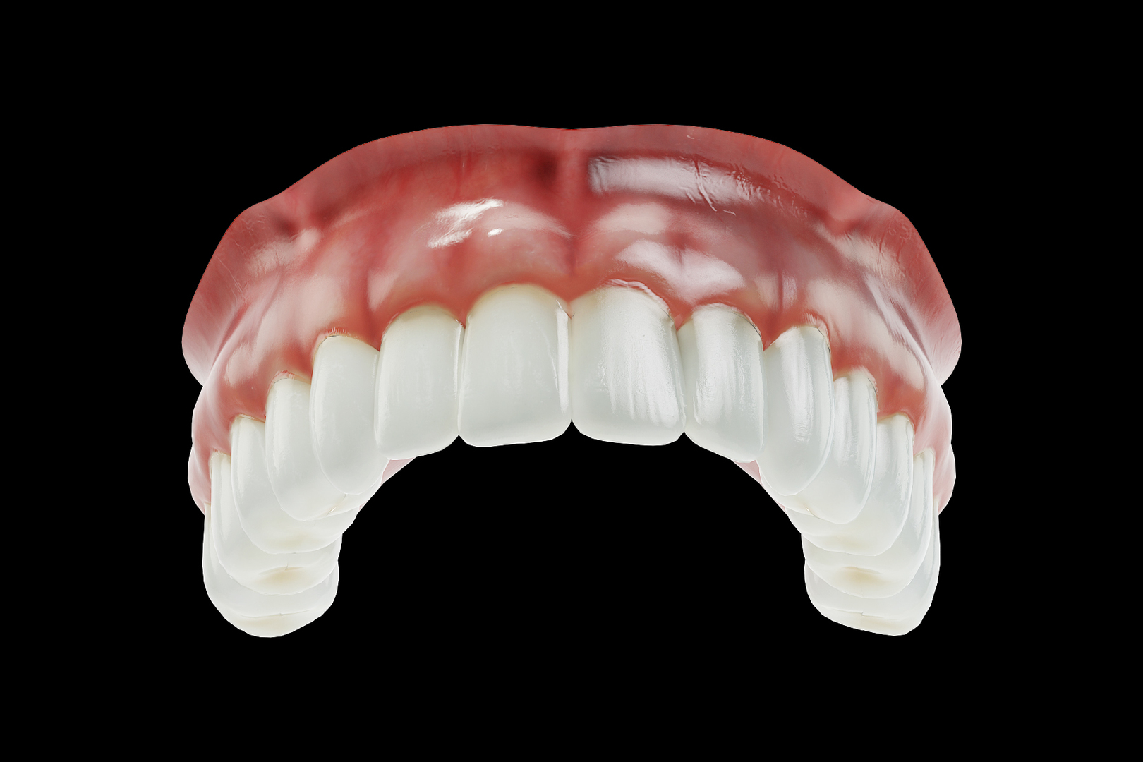 3D model human dentures upper jaw - TurboSquid 1332653