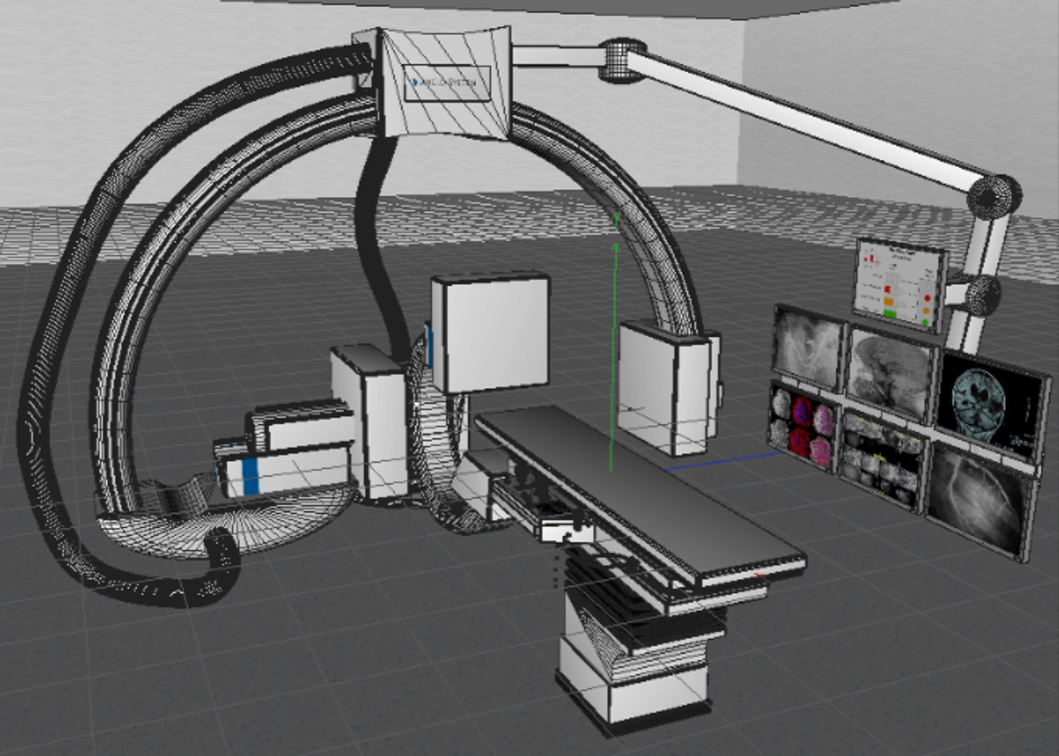 Angio Siemens Axiom 3d C4d