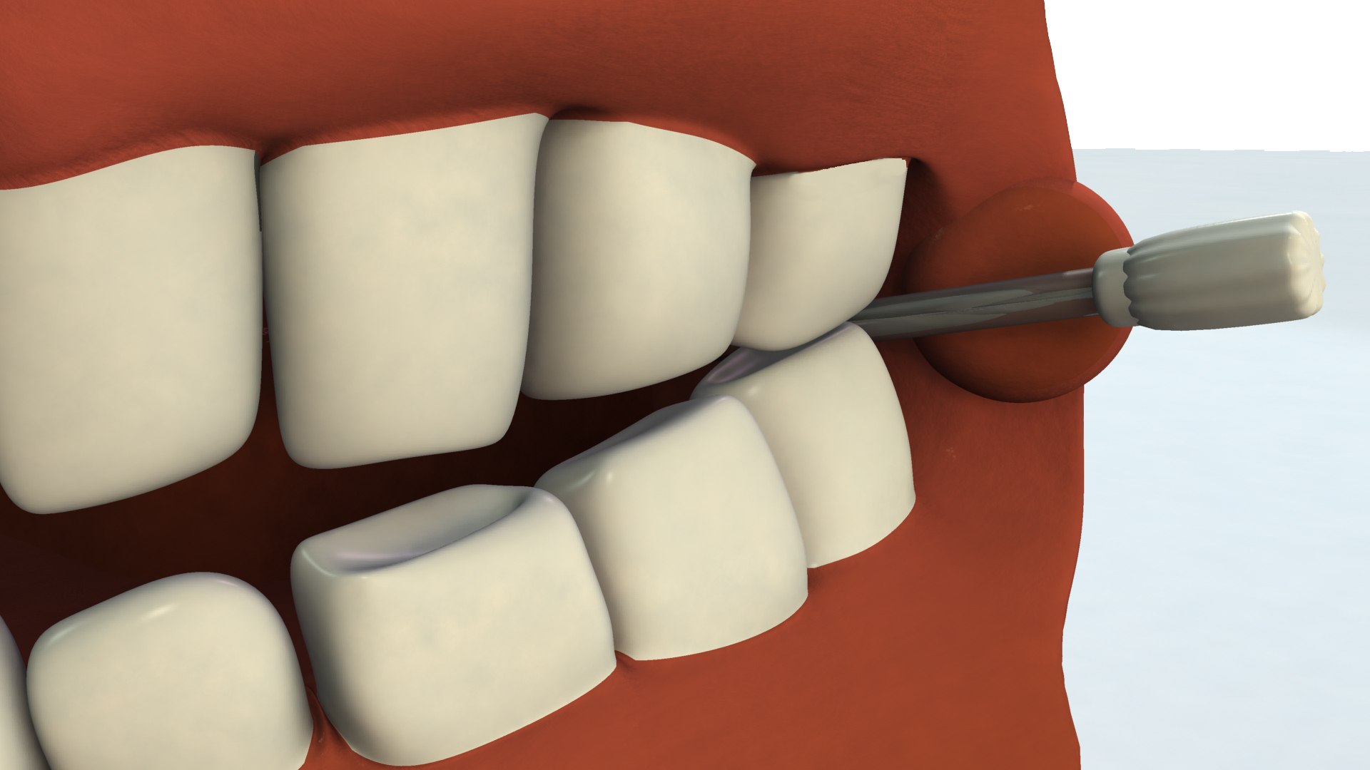 3d Chatter Teeth Model