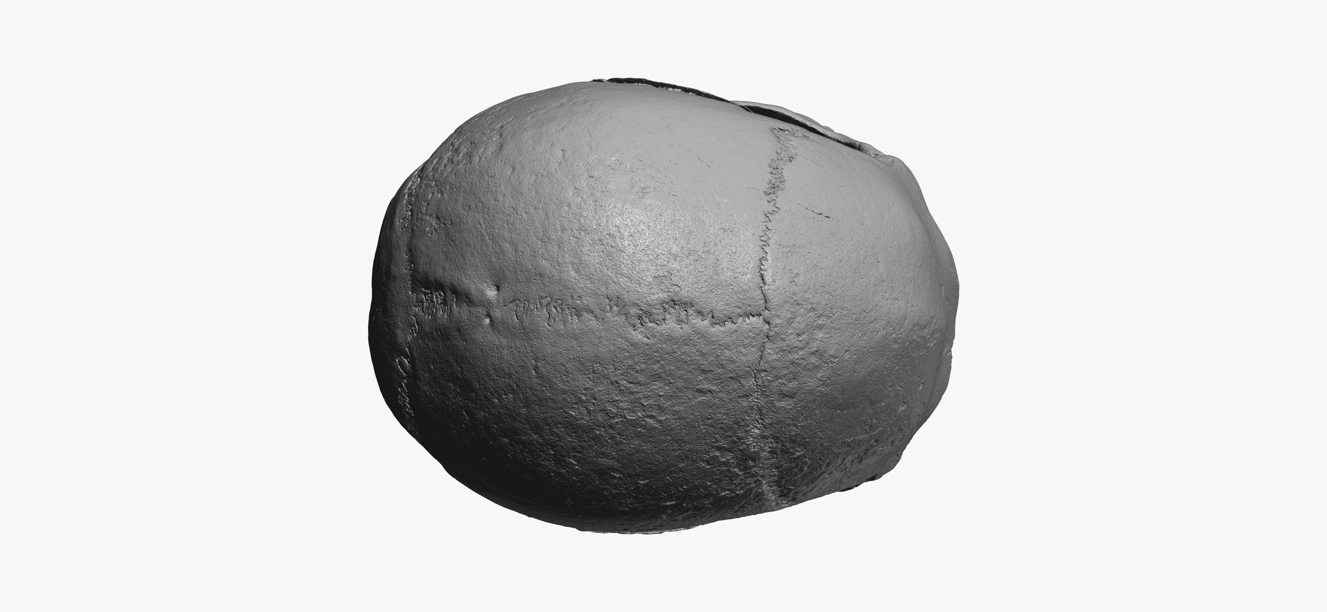 Human skull cranium leprosy 3D model - TurboSquid 1537164