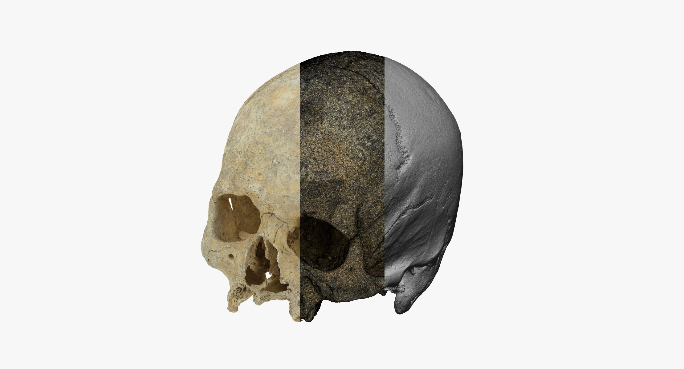 Human skull cranium leprosy 3D model - TurboSquid 1537164