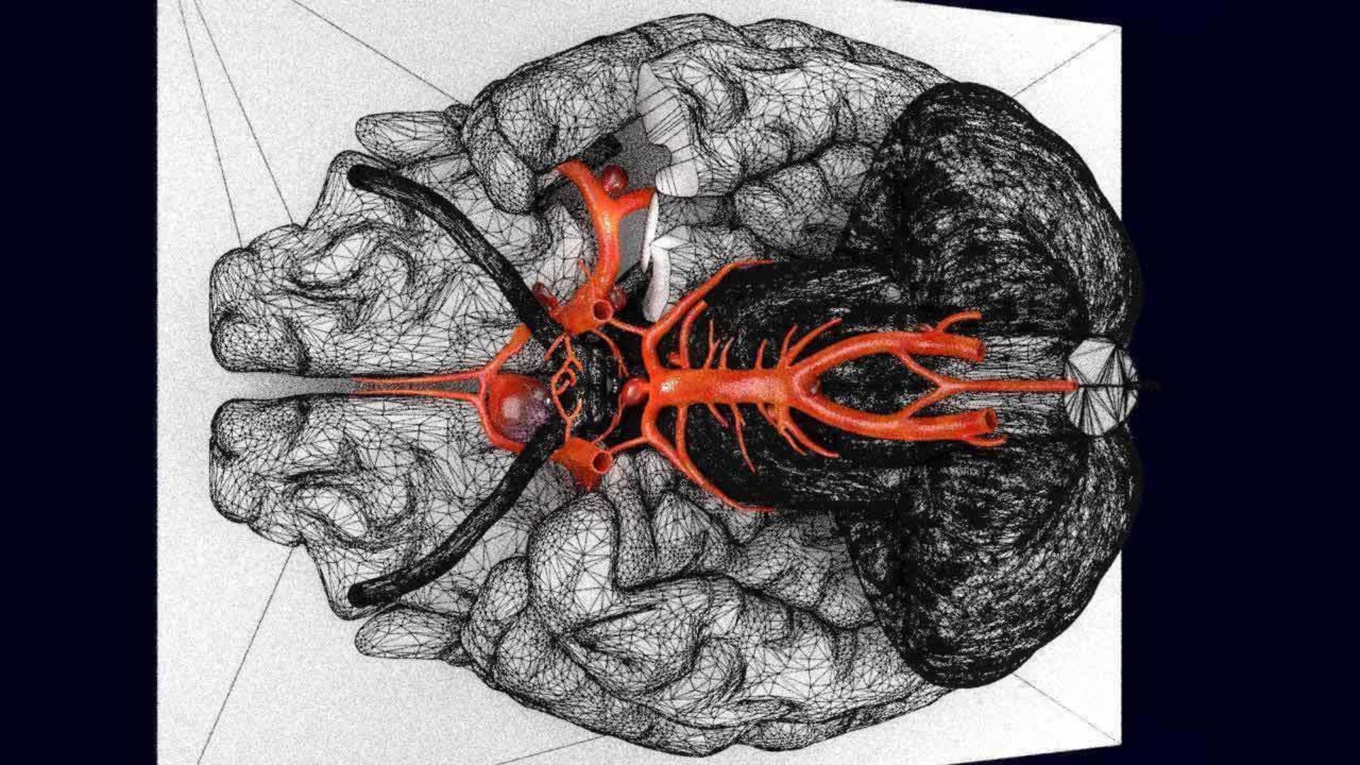 Cerebral Aneurysms Berry Circle Of Willis 3D Model - TurboSquid 2046092