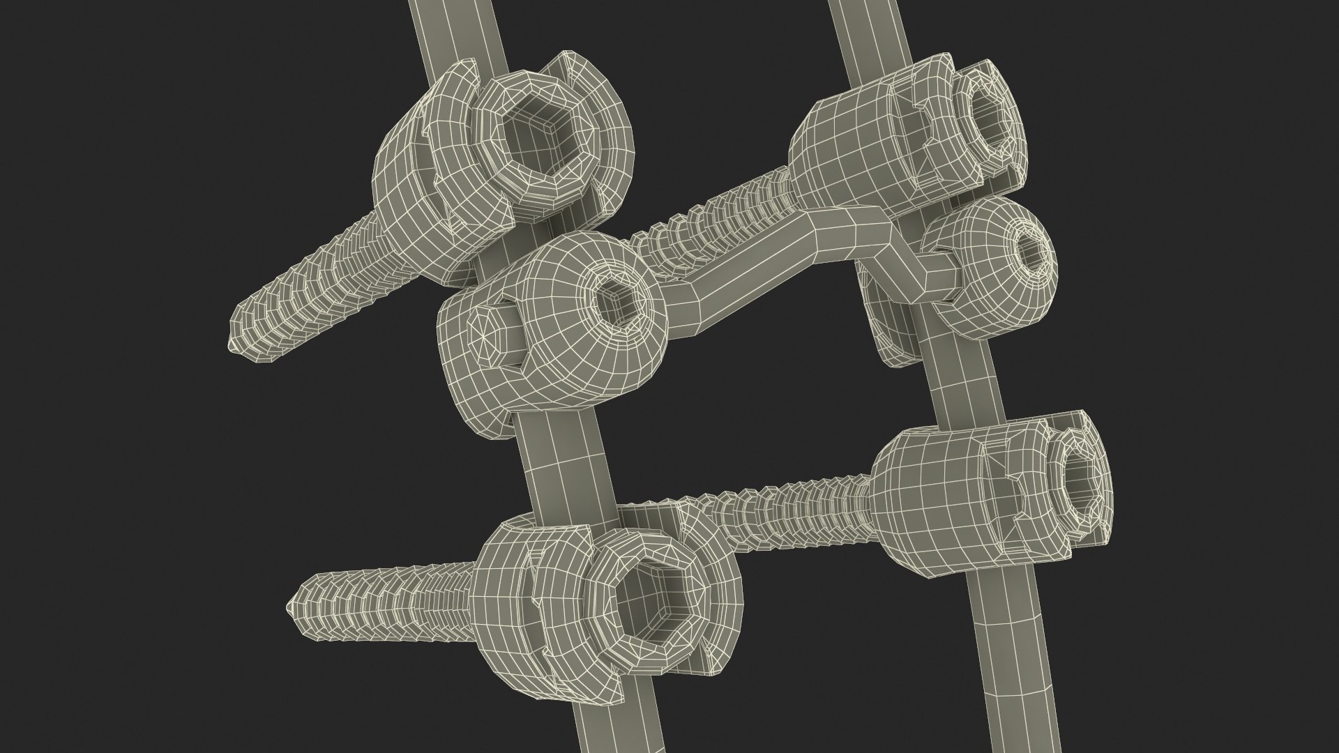 Thoracic Spine Fixation System 3D Model - TurboSquid 2206795