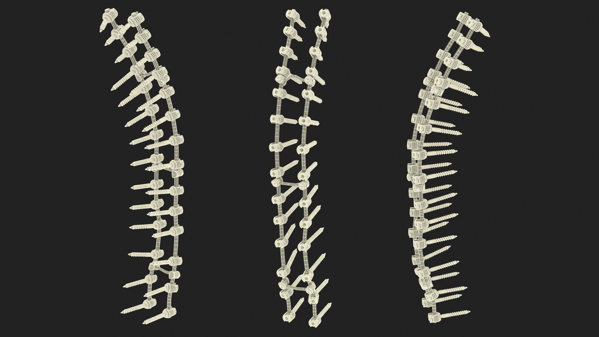 Thoracic Spine Fixation System 3D Model - TurboSquid 2206795
