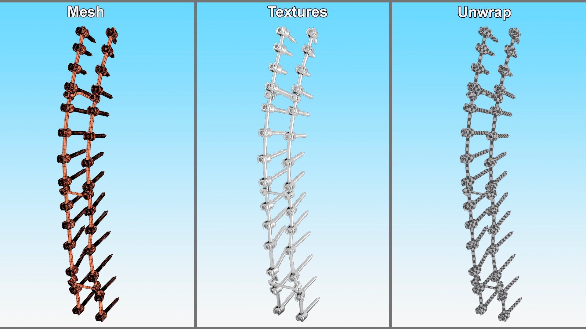 Thoracic Spine Fixation System 3D Model - TurboSquid 2206795