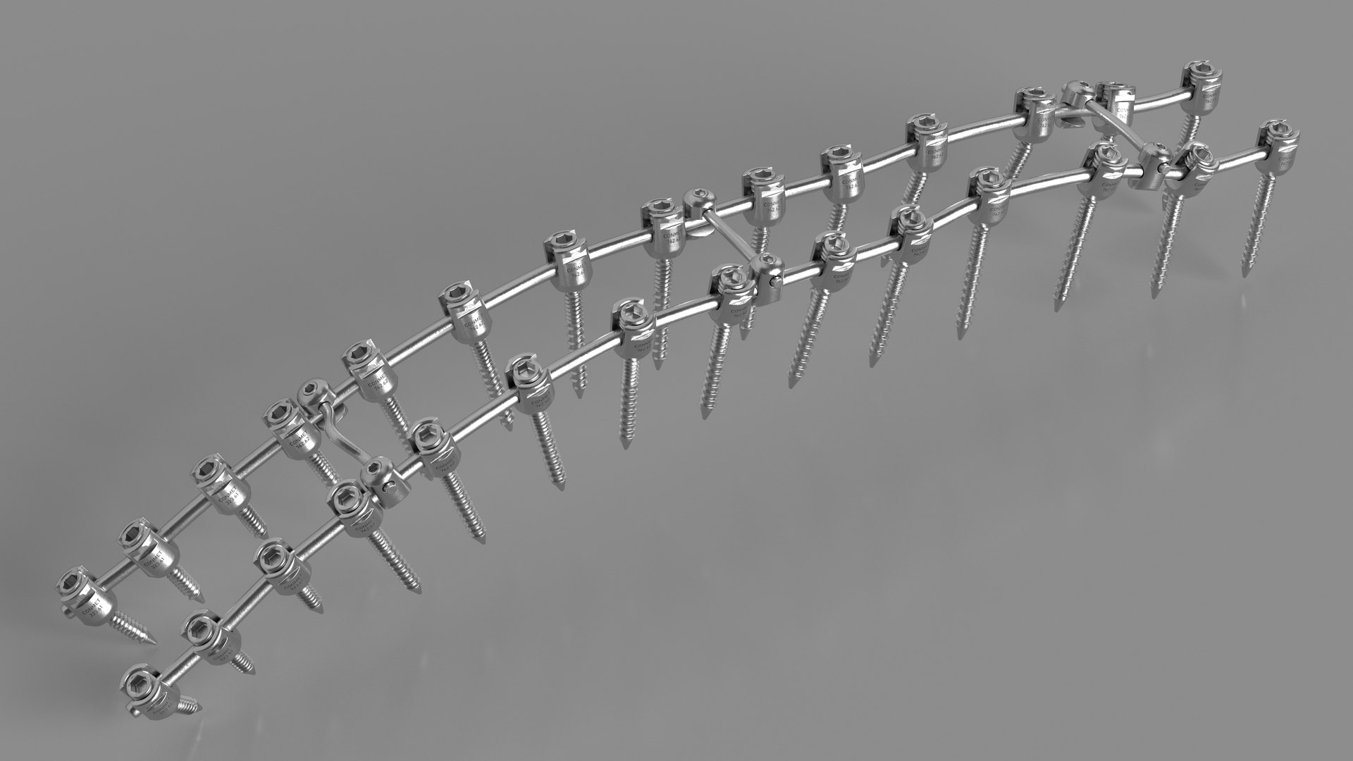Thoracic Spine Fixation System 3D Model - TurboSquid 2206795