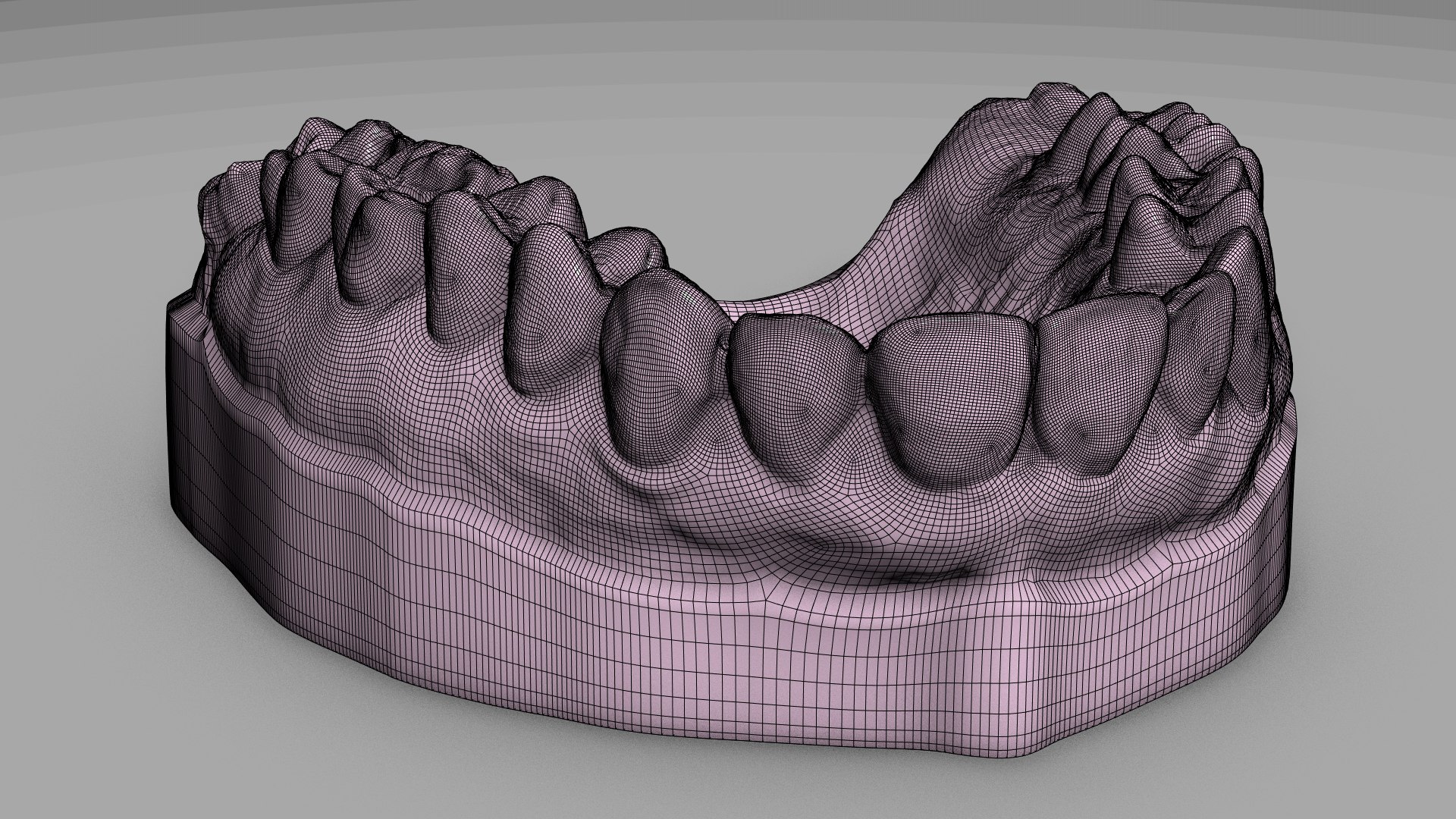 Upper Denture C Mold Model - TurboSquid 1791264