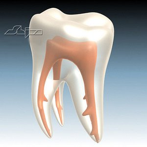 3d model gypsum mould teeth scan