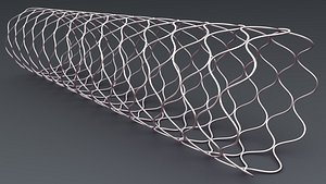 Stent 3D Models for Download | TurboSquid