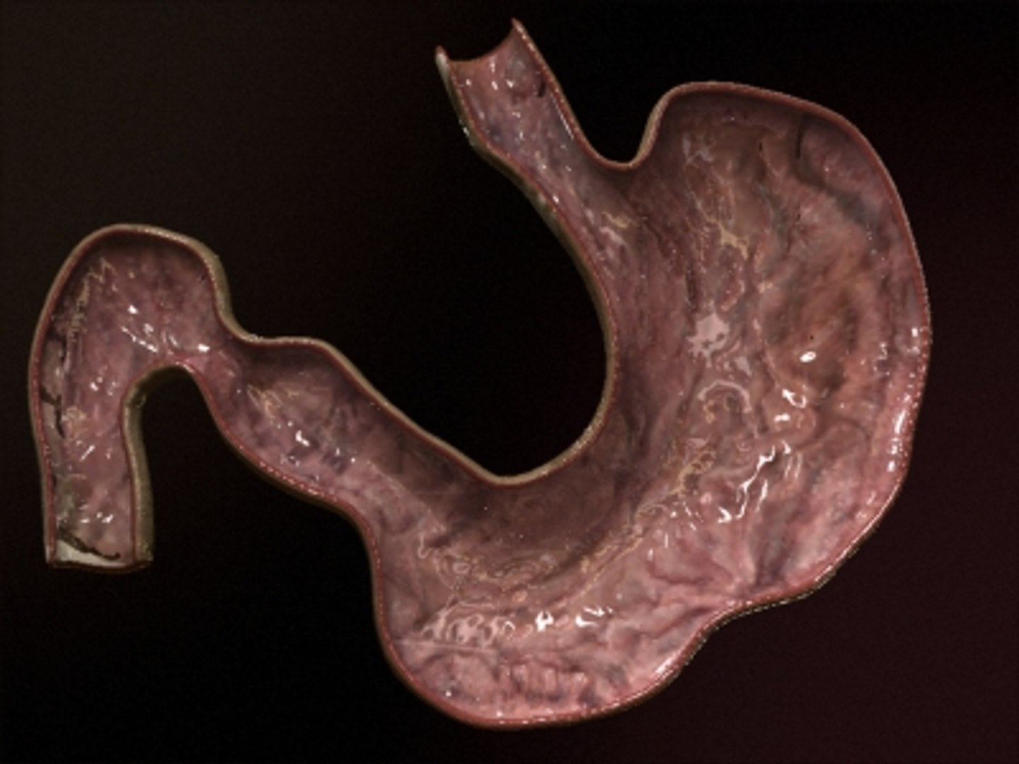 3d realistic stomach model