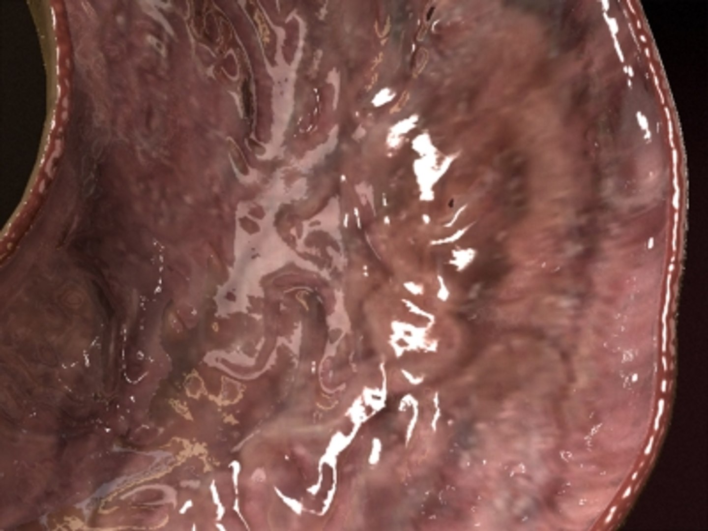 3d realistic stomach model