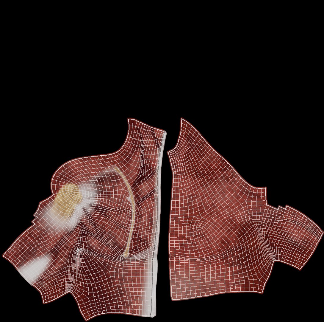 3D Human Anatomy-Muscular System-Upper Limb Superior Deep View ...