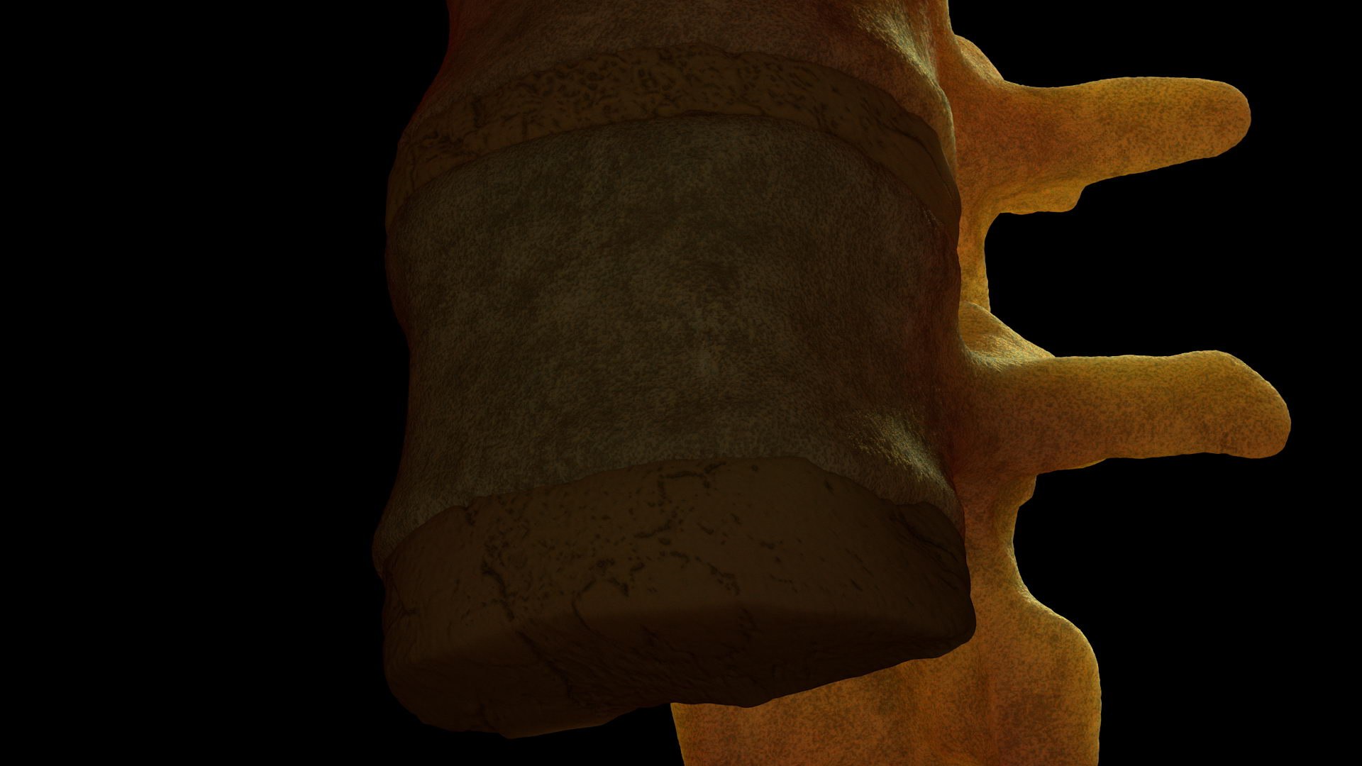 3d spinal discs bones model