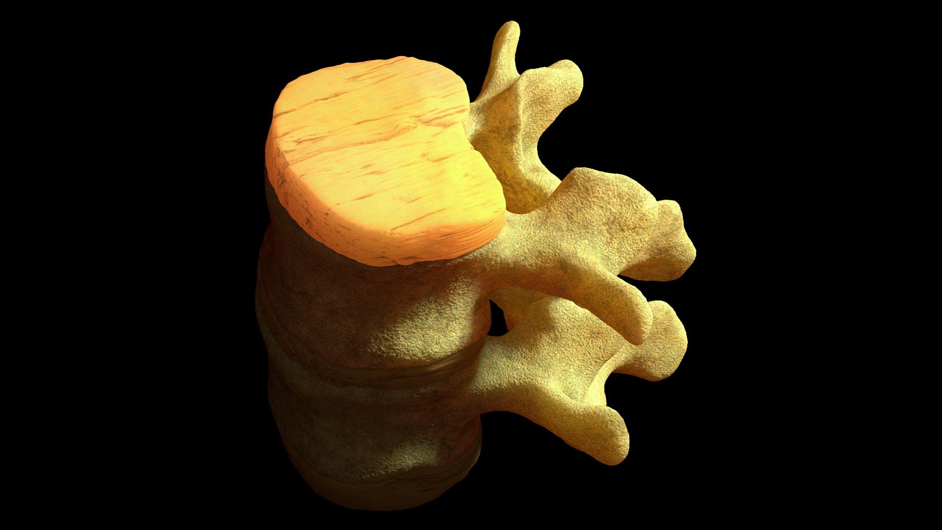 3d spinal discs bones model