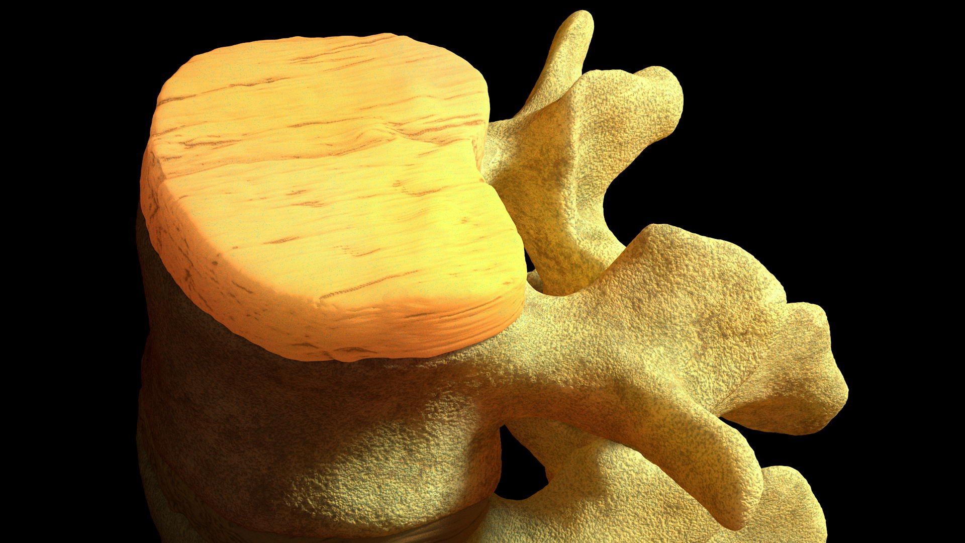 3d spinal discs bones model