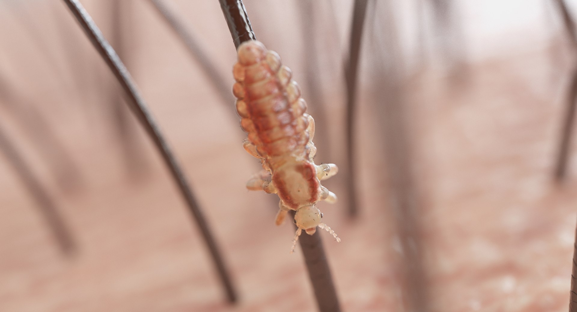 Louse animation bite model - TurboSquid 1393845