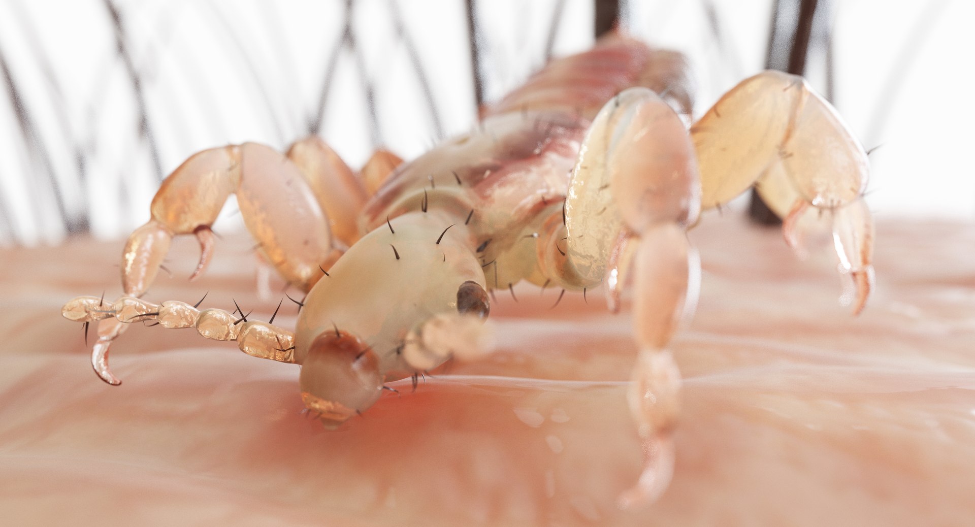 Louse animation bite model - TurboSquid 1393845