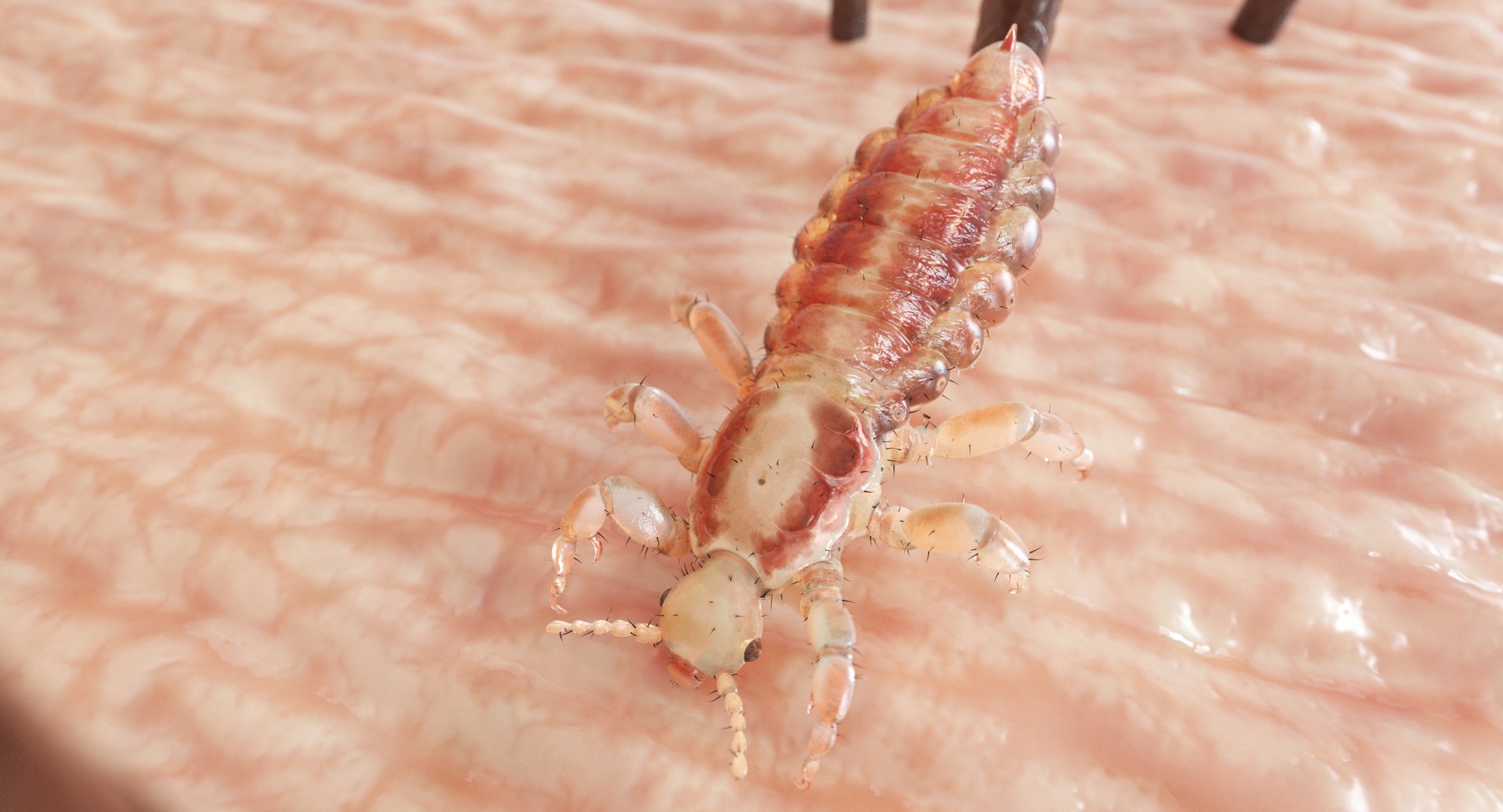Louse animation bite model - TurboSquid 1393845
