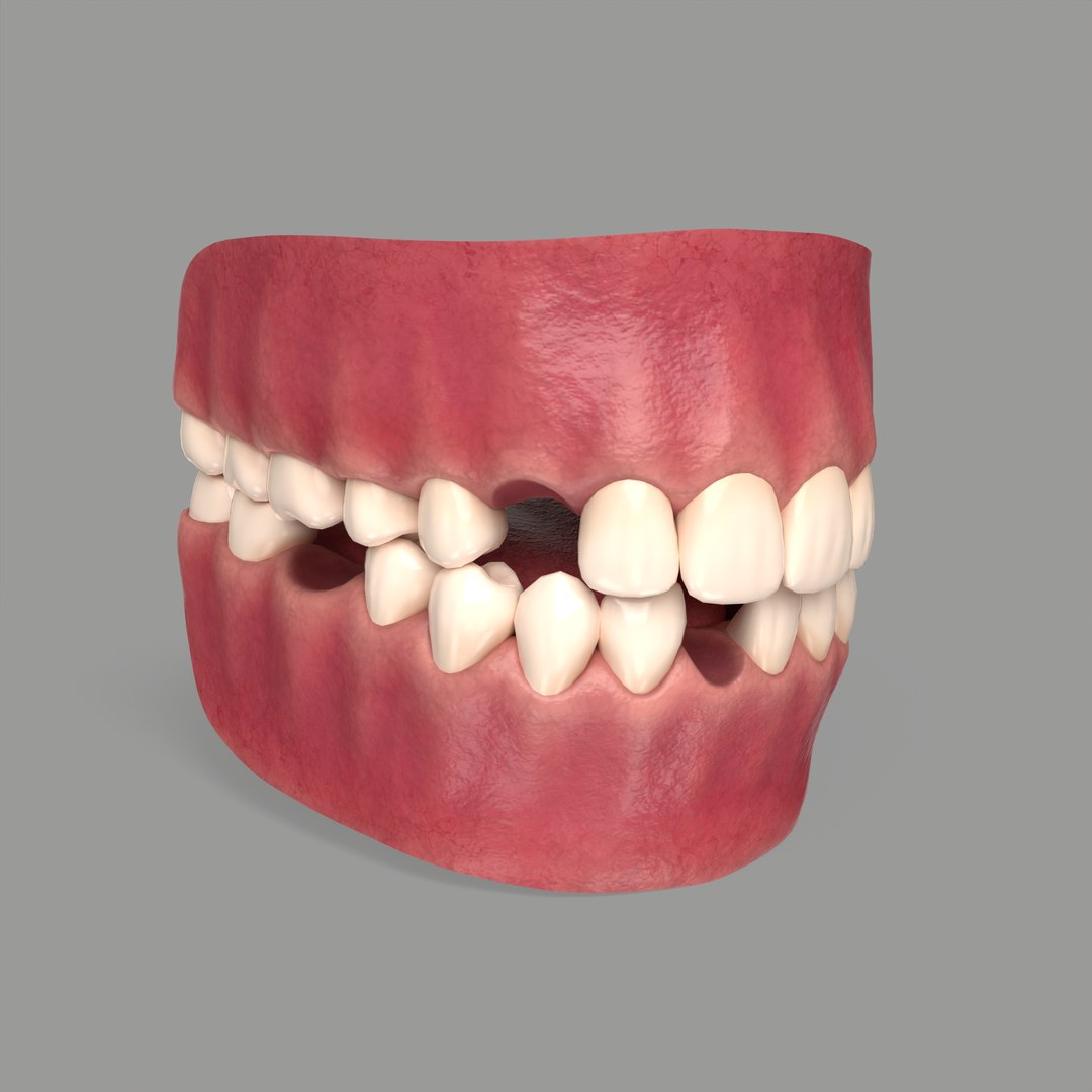 Human Teeth 3D - TurboSquid 2122171