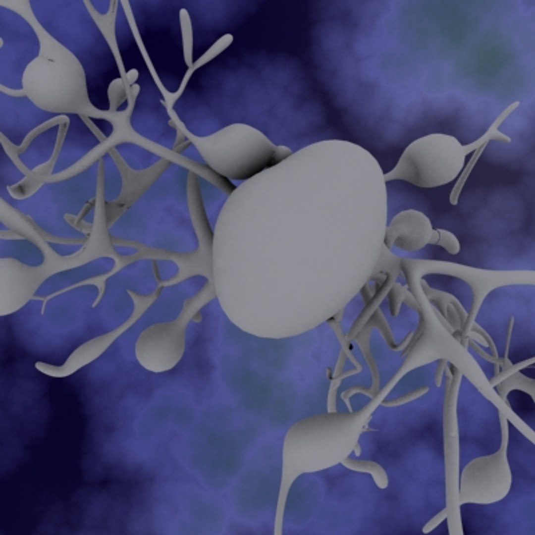 Brain Tumor 3d Model