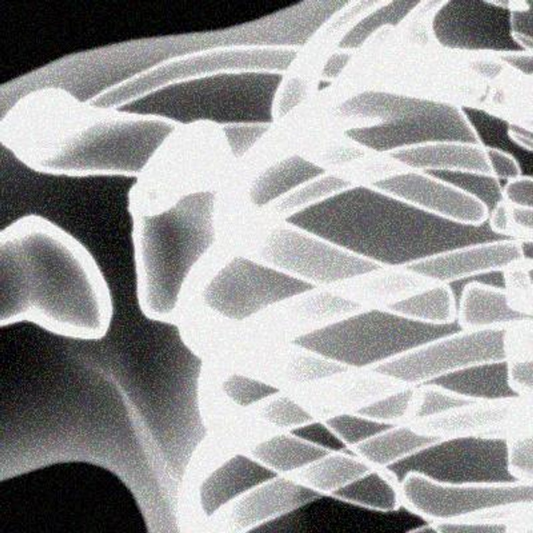 X-ray Skeleton Xray 3d Max