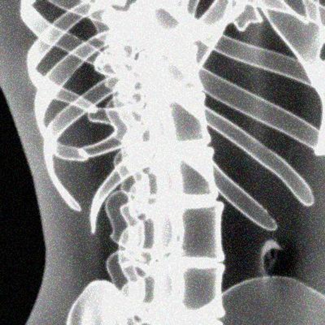 X-ray Skeleton Xray 3d Max