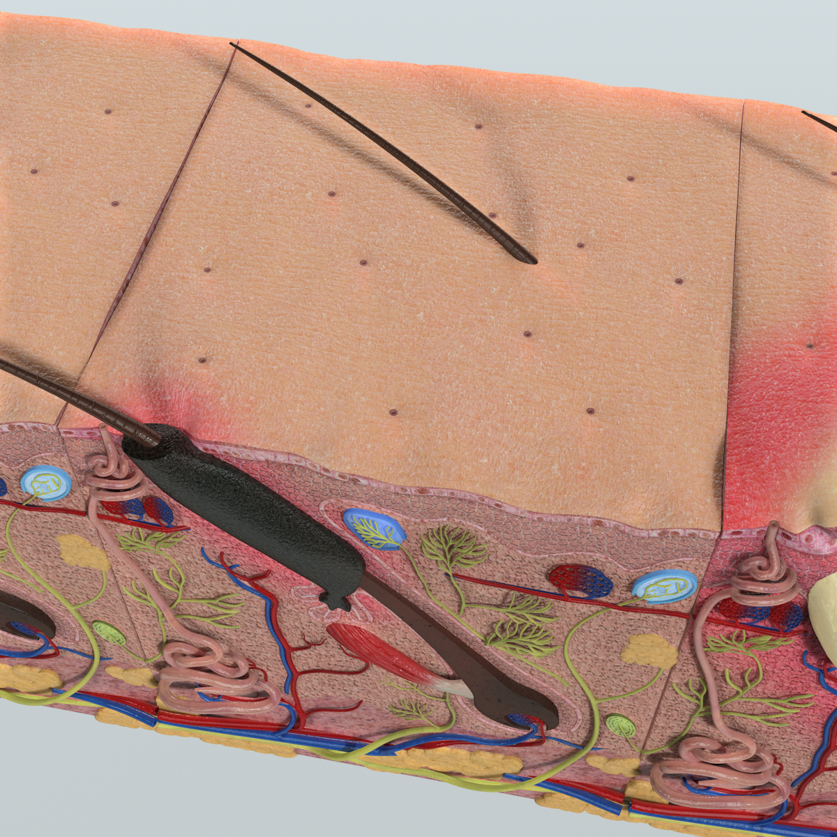 modelo 3d Anatomía realista del acné de la piel en 3D - TurboSquid 1164399