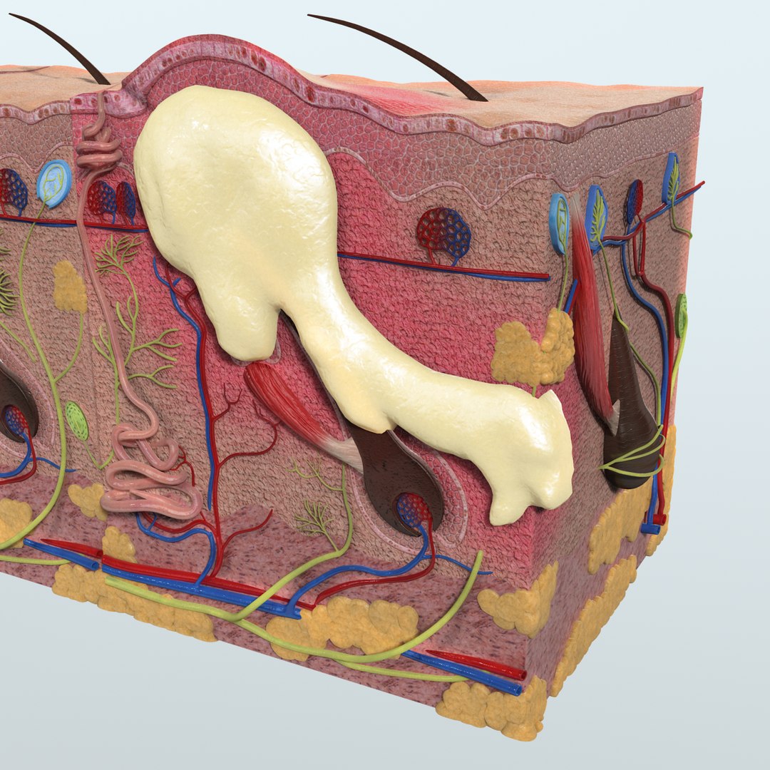 Realistic Skin Acne Anatomy 3D Model - TurboSquid 1164399