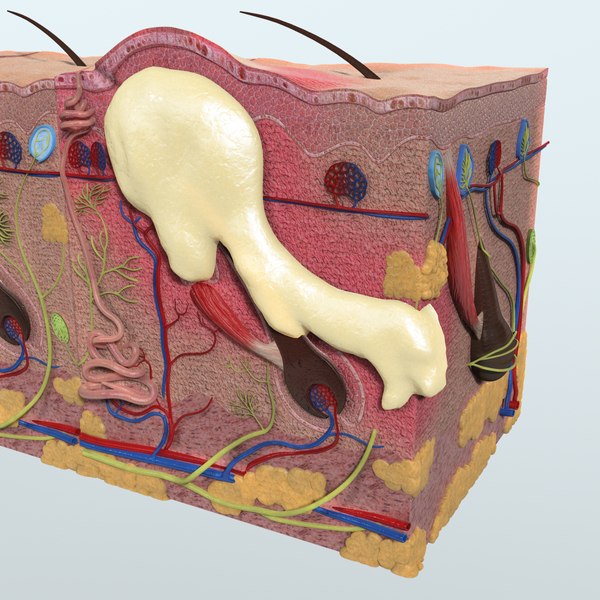 Realistic skin acne anatomy 3D model - TurboSquid 1164399